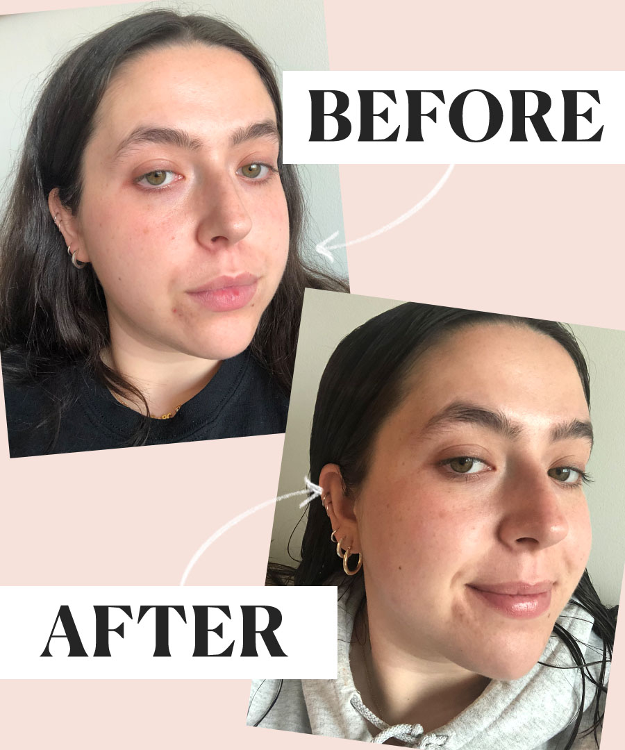 In Your 20s? Here Are the Retinol Benefits You Should Know - Pedfire In Your 20s? Here Are the Retinol Benefits You Should Know - Pedfire